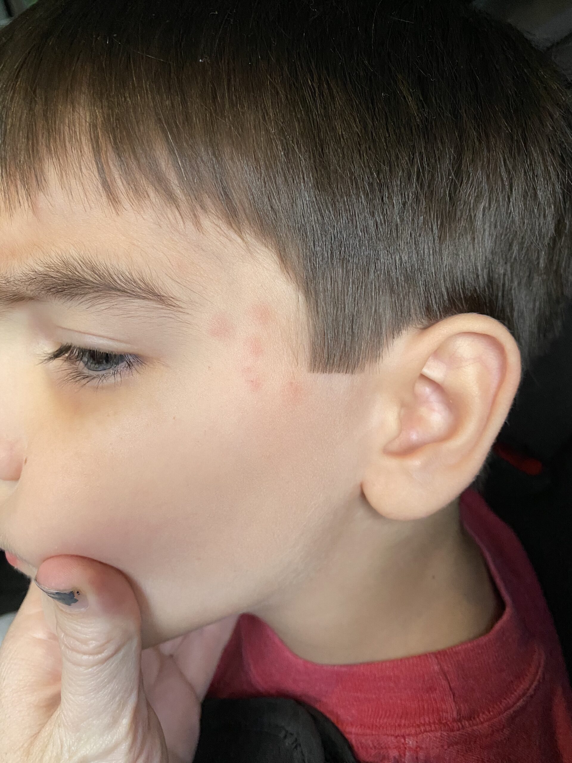 How Our Family Got Rid Of Bed Bugs: Pictures and Treatment - Amanda ...